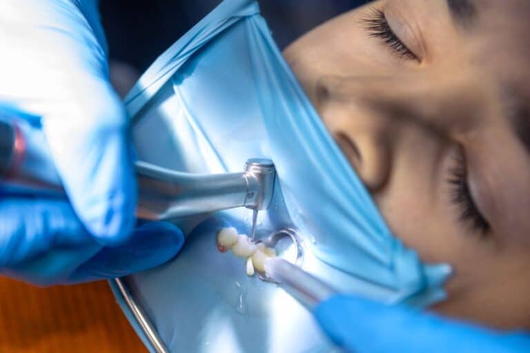 Does Extracting Wisdom Teeth Prevent Future Crowding